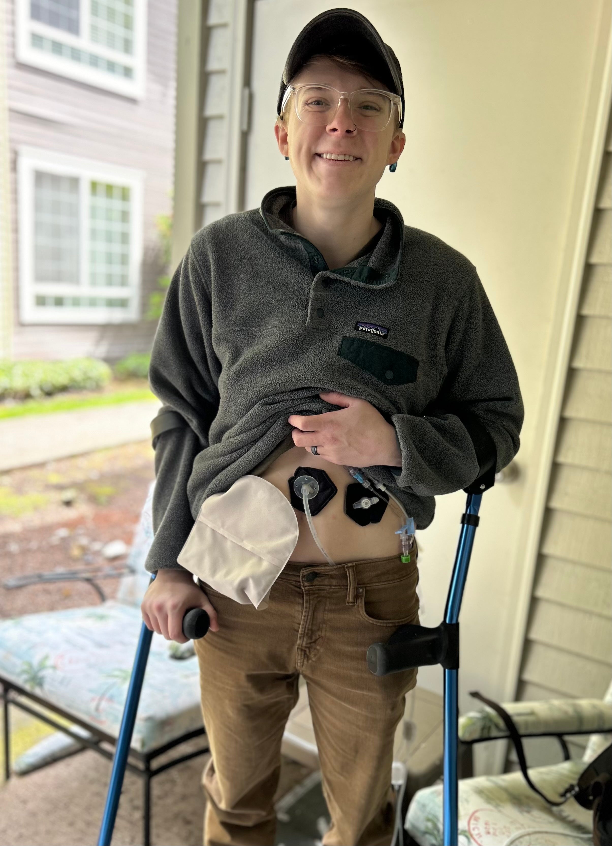 G-Tube Pads | Adaptive Apparel | Feeding Tube Care | Spoonie Threads ...